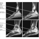 Ankle Joint Muscles, Lateral View