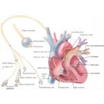 Right Heart Catheterization