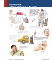 Managing Your Carbon Monoxide Poisoning