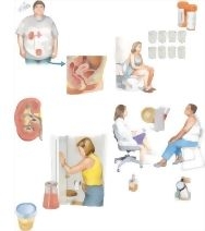 Managing Your Nongonococcal Urethritis