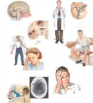 Managing Your Brain Abscess