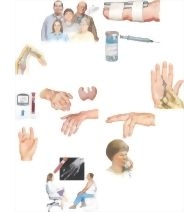 Managing Your Trigger Finger