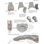 Surgical Anatomy of the Hand