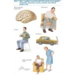 Conditions Associated With Sleep Apnea