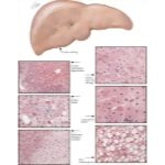 Features of Degeneration