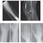 Common Injuries In Field Hockey