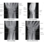 Radiology of the Forearm