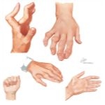 Physical Examination of the Hand