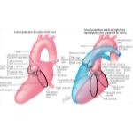 Radiology and Angiocardiography