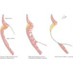 Anomalies of the Tricuspid Valve