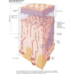 Deep Partial Thickness Injury of the Skin