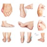 Physical Examination of the Foot and Ankle