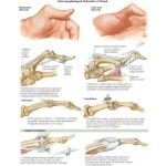 Metacarpophalangeal Deformities of Thumb