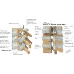 Joints of the Vertebral Arches and Bodies