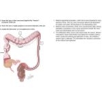 Motility of Large Intestine Colonic Motility