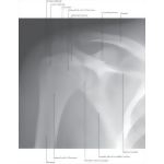 Shoulder: Anteroposterior Radiograph