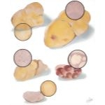 Pathology of the Ovary