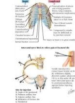 Thoracic Cage Injuries and Anesthesia