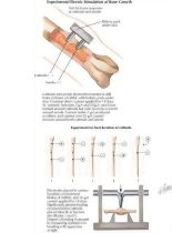 Experimental Electric Stimulation of Bone Growth