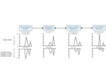 Echo-Doppler Criteria for Assessment of Diastolic Function