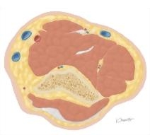 Cross Section of the Elbow: Axial View
