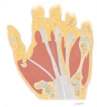 Cross Section of the Hand: Coronal View