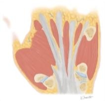 Cross Section of the Hand: Coronal View