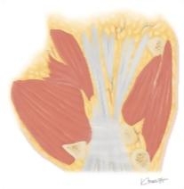 Cross Section of the Hand: Coronal View