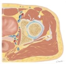 Cross Section of the Hip: Axial View
