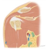 Cross Section of the Shoulder: Coronal View