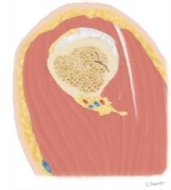 Cross Section of the Shoulder: Sagittal View
