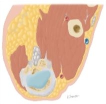 Cross Section of the Thumb: Axial View