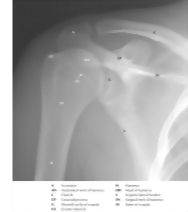 Shoulder: Anteroposterior Radiograph
