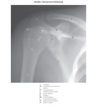 Shoulder: Anteroposterior Radiograph