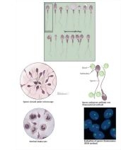 Semen Analysis and Sperm Morphology
