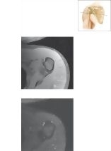 Cross Section of the Shoulder: Axial View