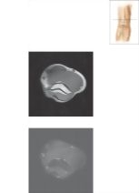 Cross Section of the Elbow: Axial View