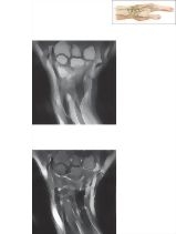 Cross Section of the Wrist: Coronal View