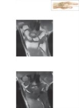 Cross Section of the Wrist: Coronal View