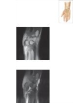 Cross Section of the Wrist: Sagittal View
