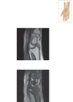 Cross Section of the Wrist: Sagittal View