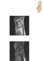 Cross Section of the Wrist: Sagittal View