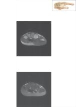 Cross Section of the Hand: Axial View