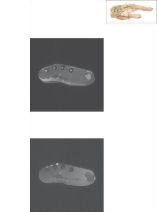 Cross Section of the Hand: Axial View