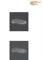 Cross Section of the Hand: Axial View