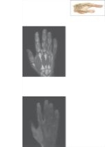 Cross Section of the Hand and Finger: Coronal View