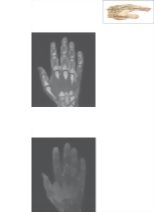 Cross Section of the Hand and Finger: Coronal View