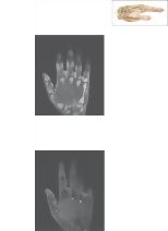 Cross Section of the Hand and Finger: Coronal View