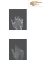 Cross Section of the Hand and Finger: Coronal View