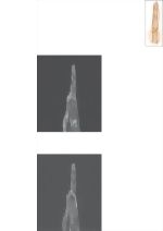 Cross Section of the Hand and Finger: Sagittal View